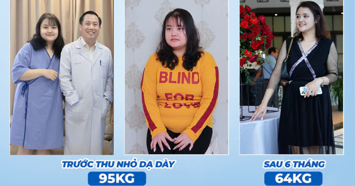 Giảm 20kg sau 2 tháng nhờ phẫu thuật nội soi thu nhỏ dạ dày cùng PGS.TS.BS Nguyễn Anh Tuấn